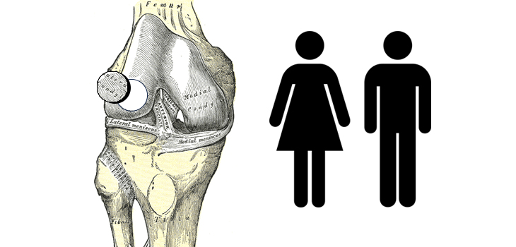 Patient Story on the Life Changing power of Cartilage Transplantation