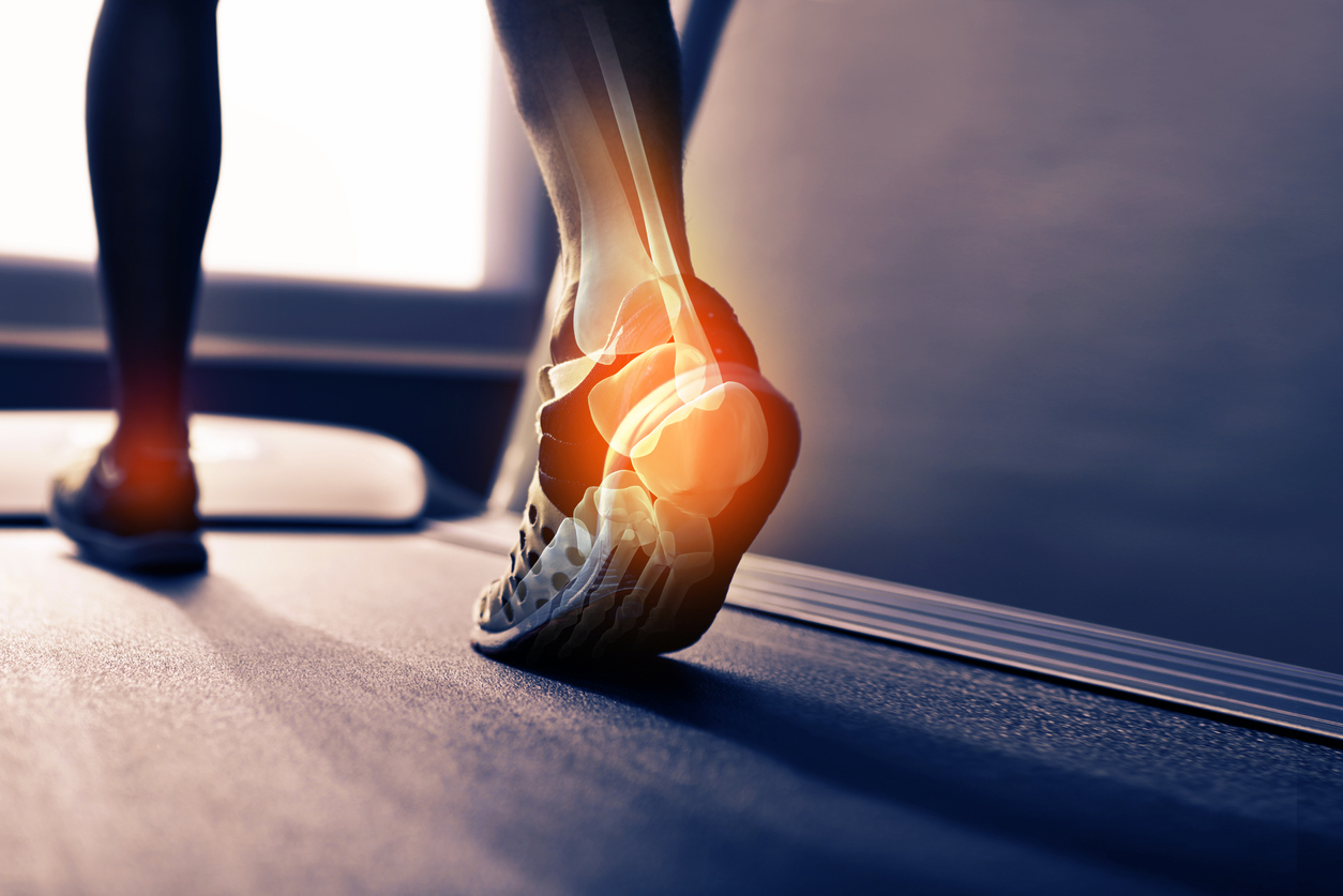 What are the Most Common Foot Injuries in Sports?