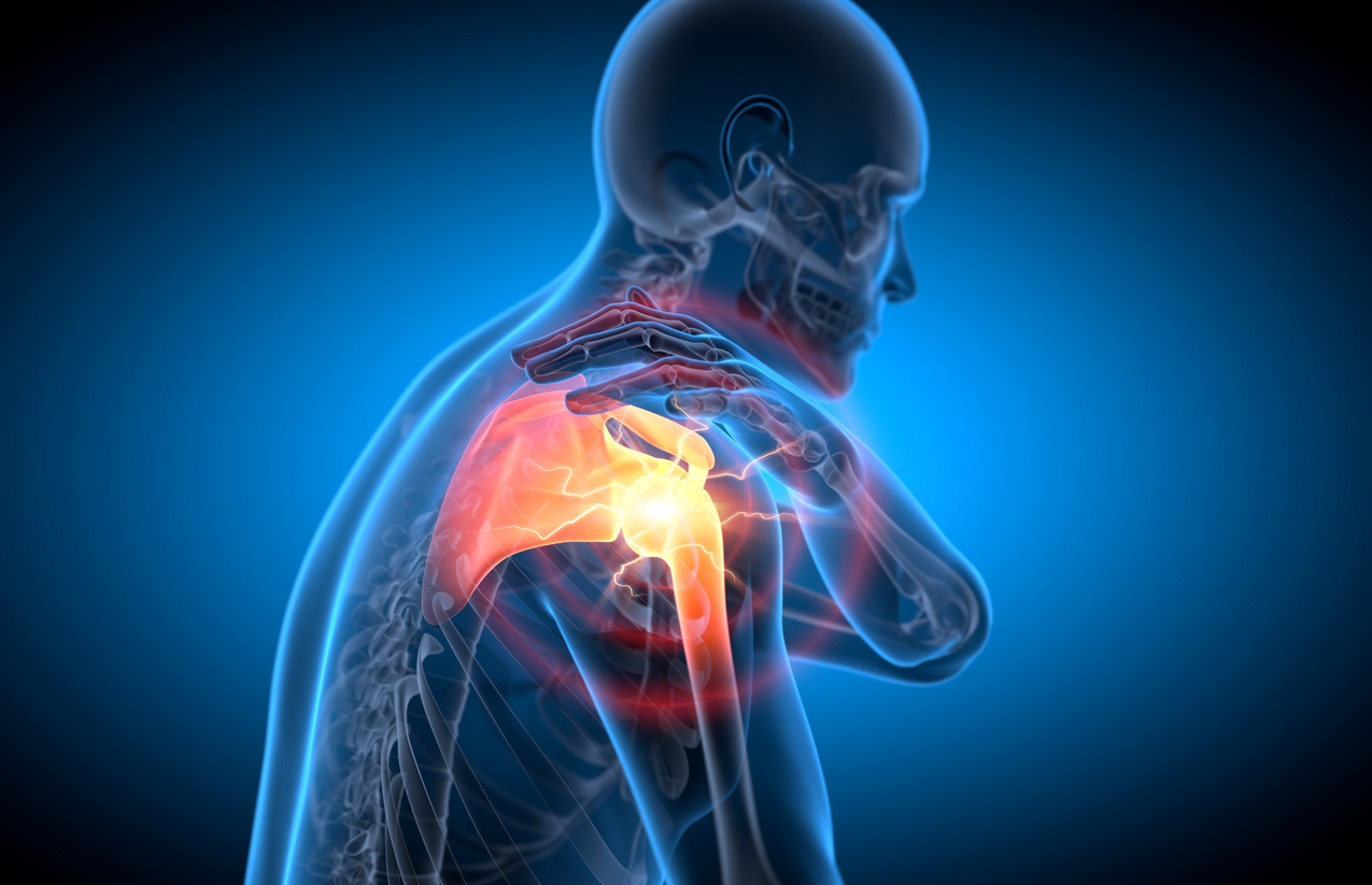 Minimally Invasive Shoulder Joint Replacement Chicago | Shoulder ...
